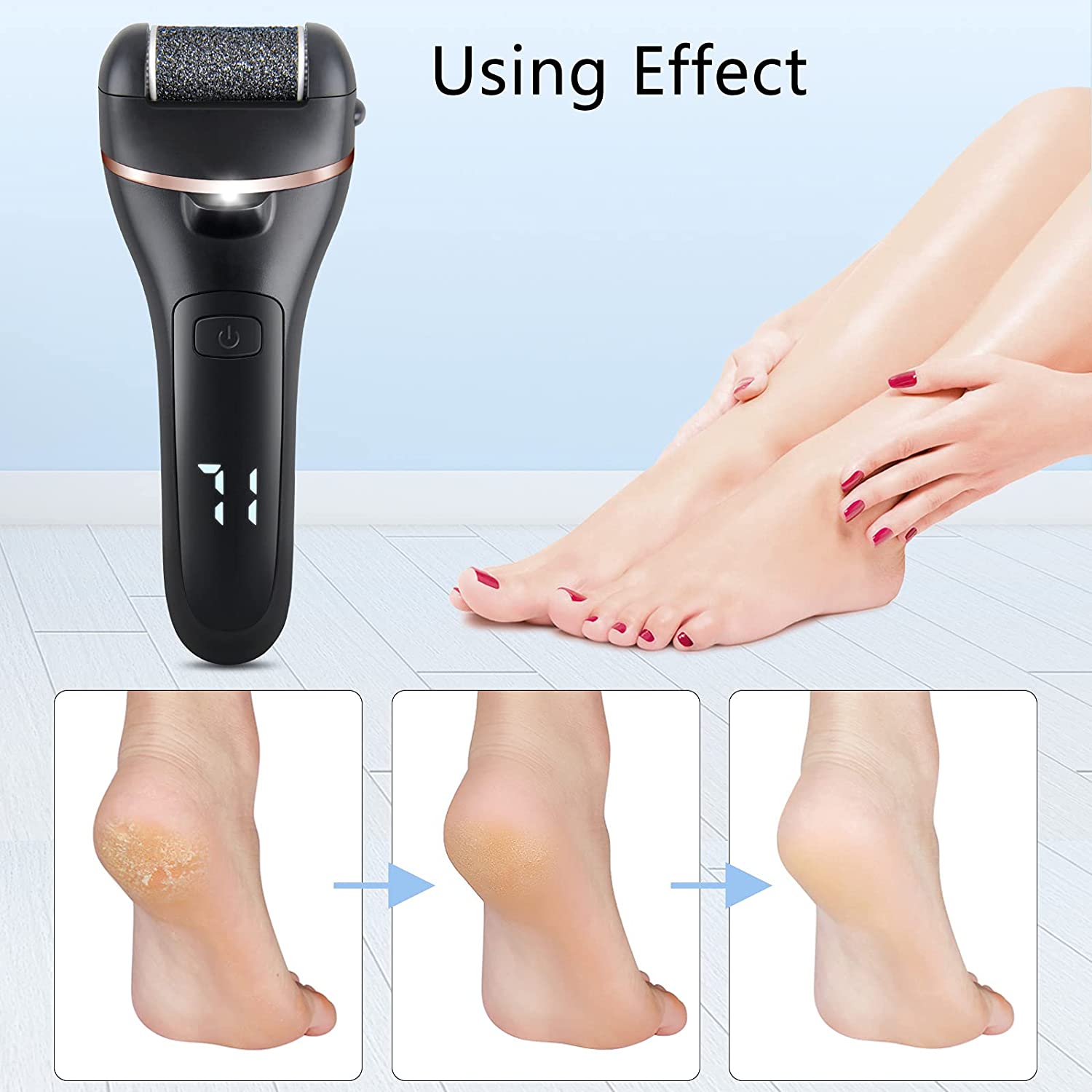 Electric Foot File Pedicure Set– salelink.co.nz